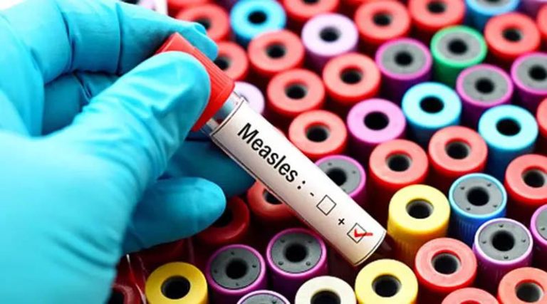 Measles death toll in Bangladesh climbs to 601 as seven more children ...